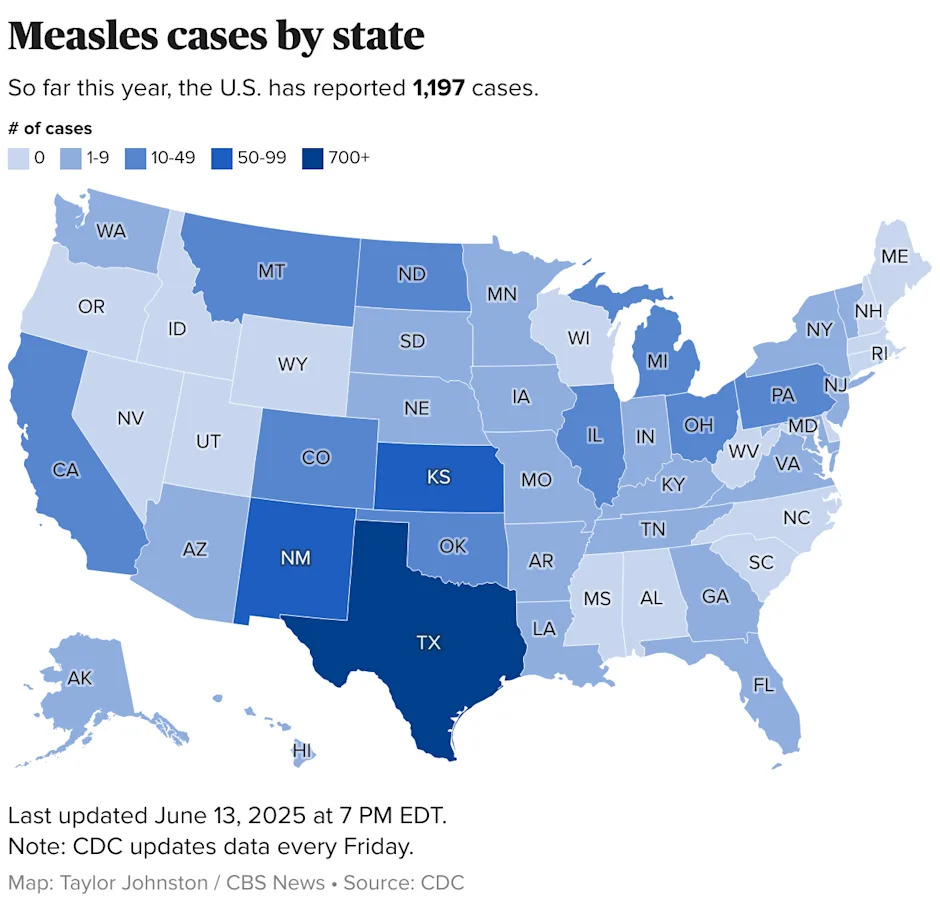 Measles Surge in 2025: Over 2,000 Cases Across 44 States; West Texas ...